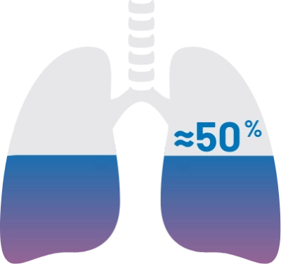 Risk Factors for & Manifestations of cGVHD